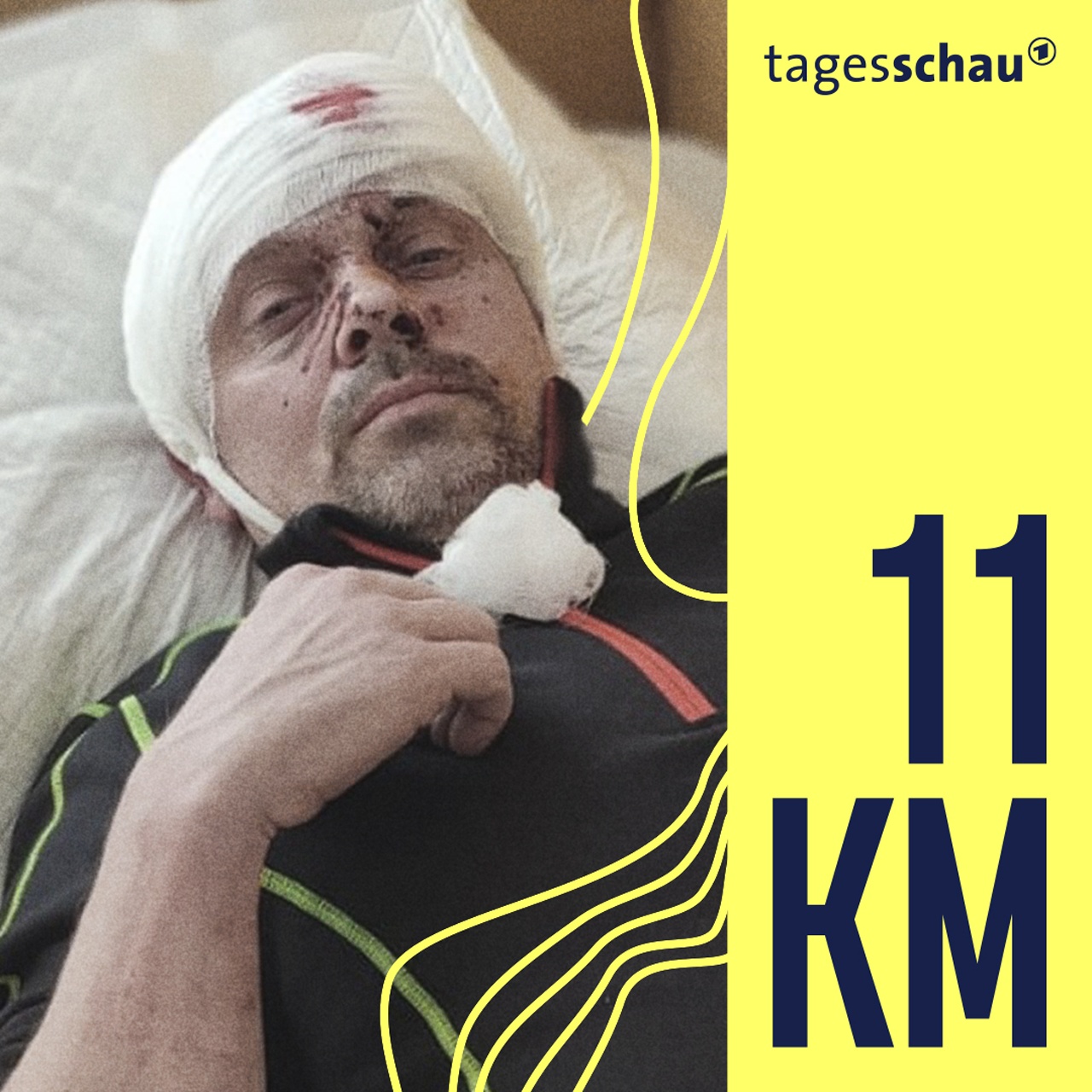 11KM: der tagesschau-Podcast · Verwundet in der Ukraine ...